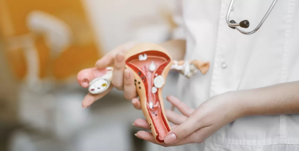 Miomas uterinos: estudio de Mayo Clinic compara los tratamientos ...